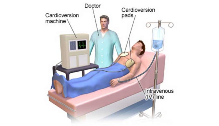 Cardioversion Test | Top Cardioversion Test Clinic Pimlico
